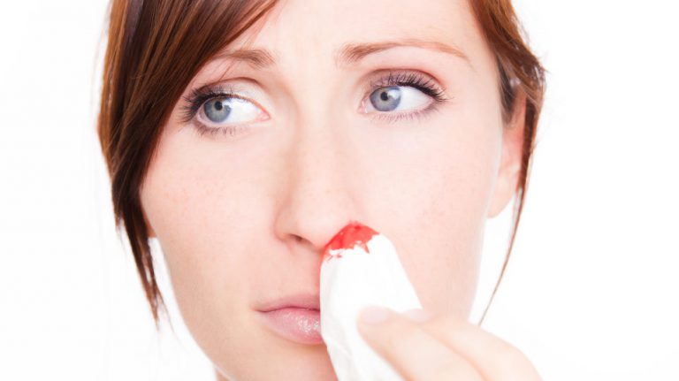 Sangrado nasal (epistaxis) - Àrea Otomèdic